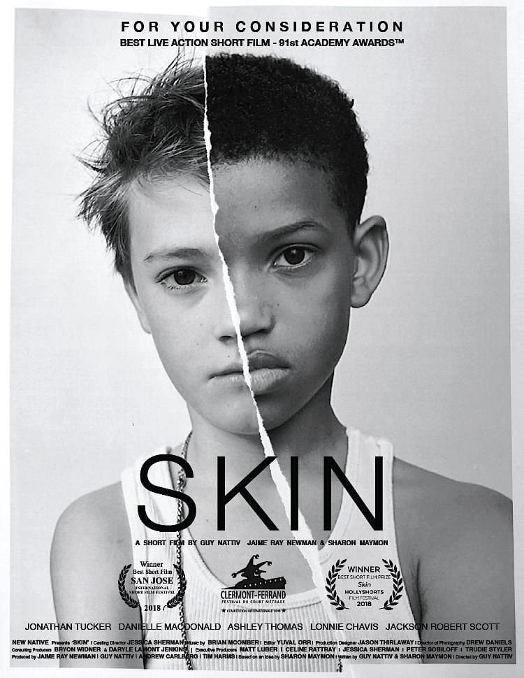 Skin (Short) - Kurzfilm - FILMSTARTS.de